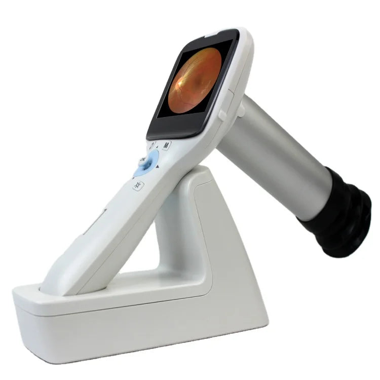 Top Portable Fundus Camera for Eye Examinations and Retinal Imaging in ...